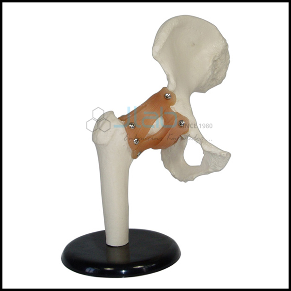 Hip Implants Model India, Manufacturers, Suppliers & Exporters in India