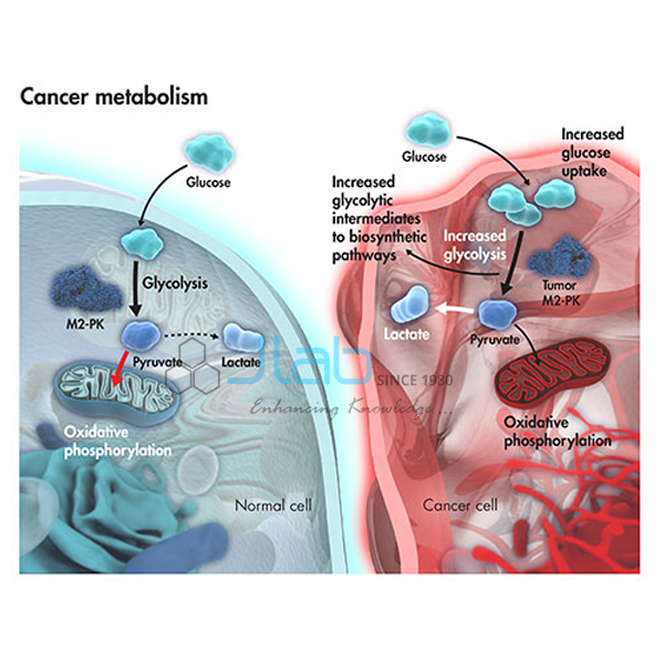 Cancer Metabolism Model India, Cancer Metabolism Model Manufacturer ...