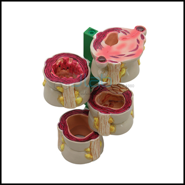 Colon Model Set of 4 Pcs India, Manufacturers, Suppliers & Exporters in ...