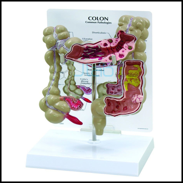 Colon Model With Pathologies India, Manufacturers, Suppliers ...